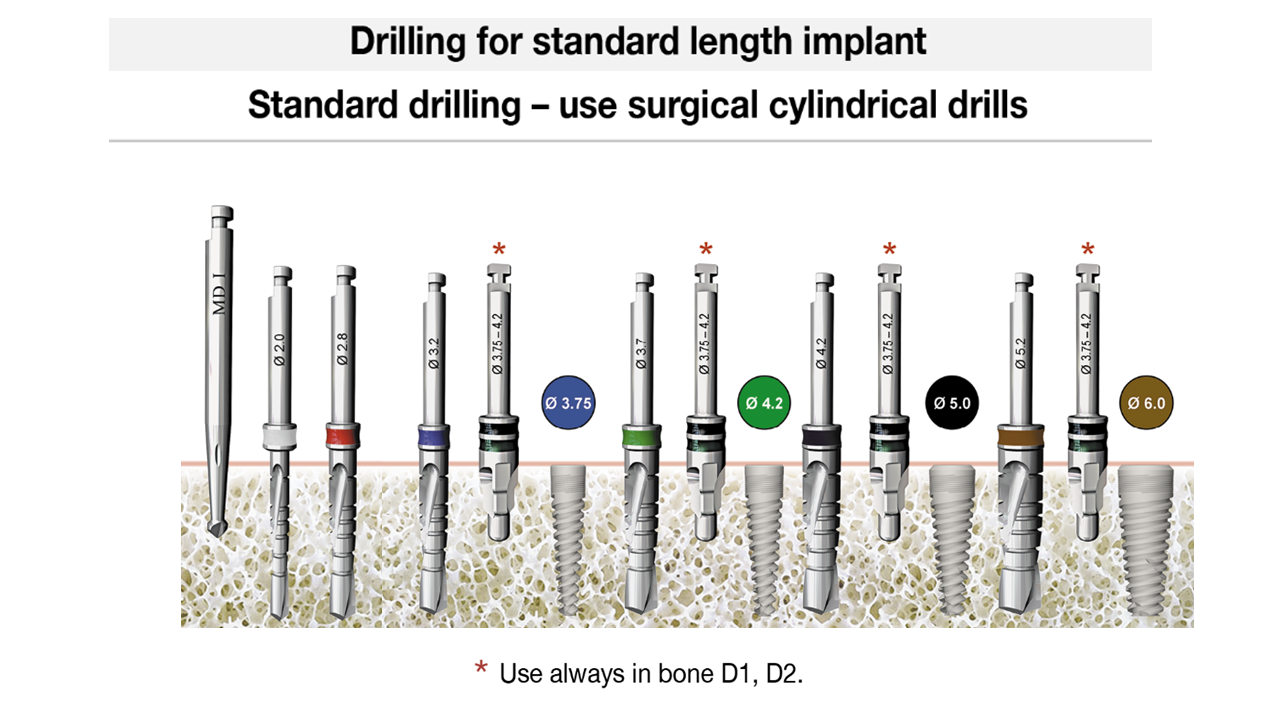 Unique Titanium Implant Hex 2.43 Multi-Lock | Dental Implant System - DMi